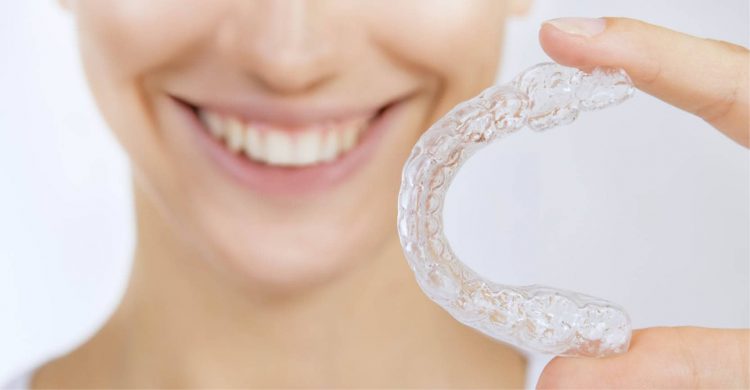 What Are Invisible Braces: Everything You Need To Know - my fashion life